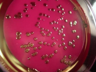 m-Les Endo Agar Medium - LABFAB