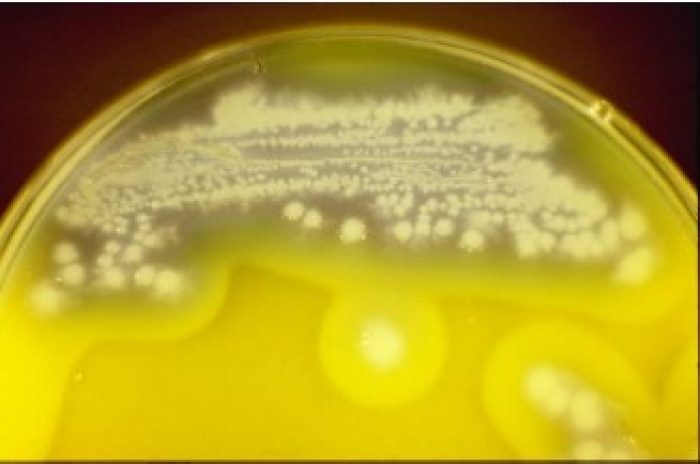 Bacillus Cereus Selective Agar (PEMBA) - LABFAB