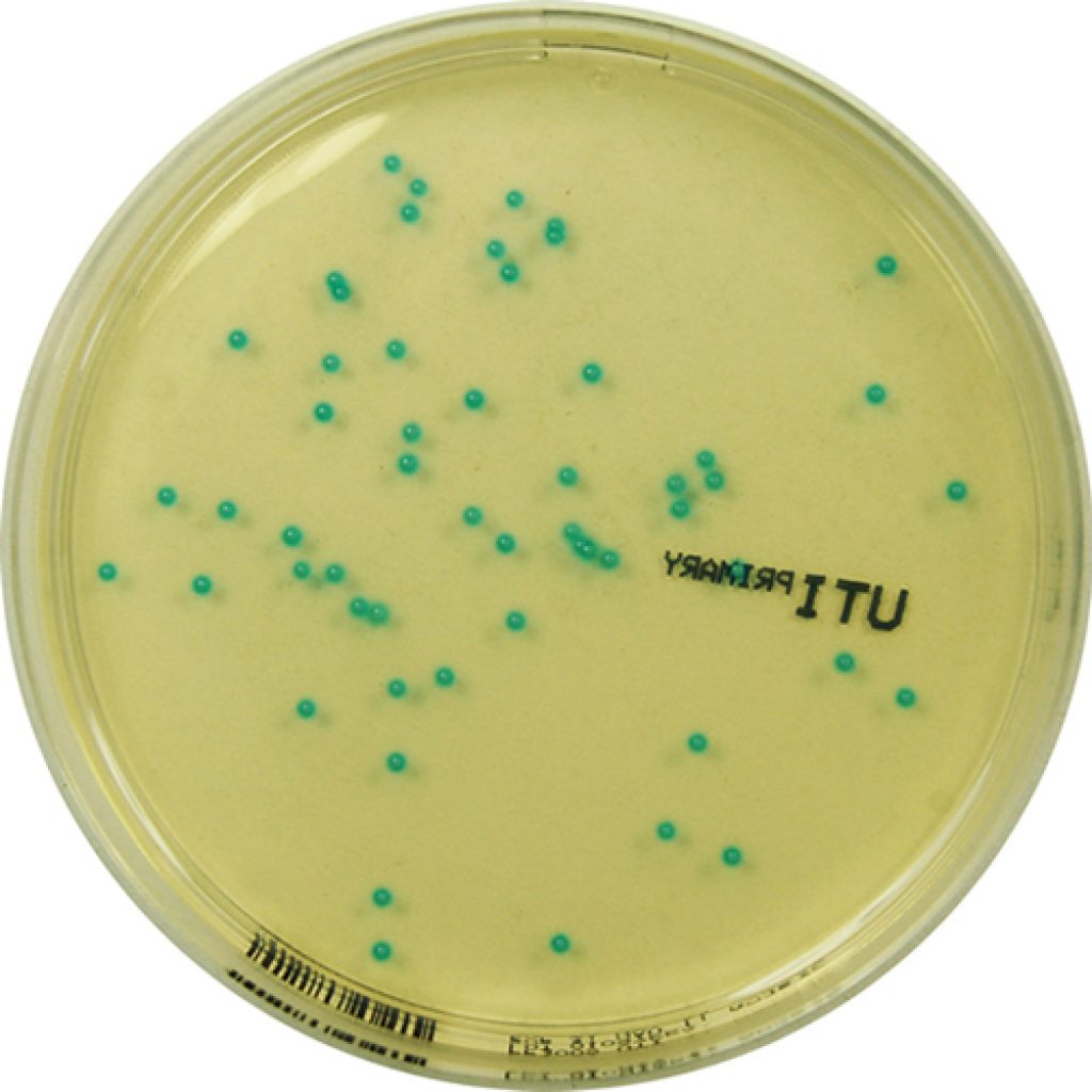 Primary UTI Chromogenic Agar - LABFAB