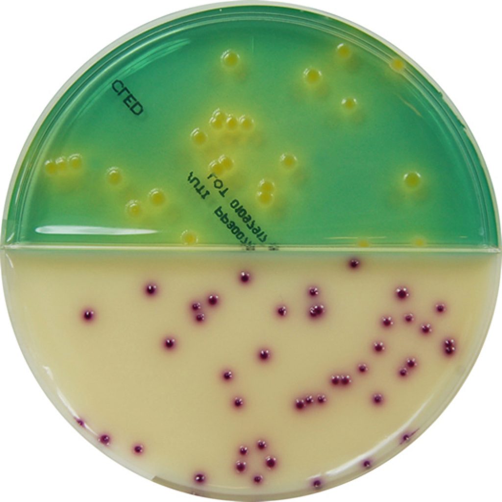 CLED Agar/Primary UTI Chromogenic Agar (Opaque) - LABFAB