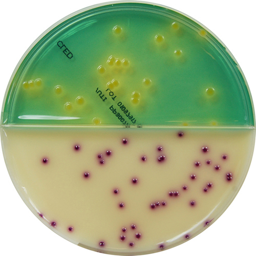 CLED Agar/Primary UTI Chromogenic Agar (Opaque) - LABFAB