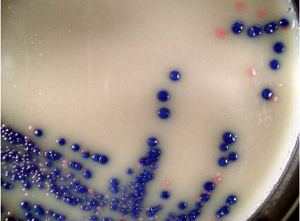 ESBL agar (CE) - ChromArt - LABFAB